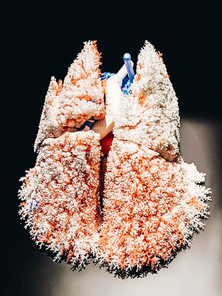 The BODIES Exhibition in Las Vegas, Nevada